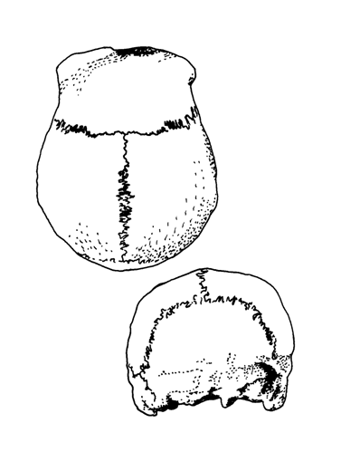 Sutures of the skull – Human From The Beginning